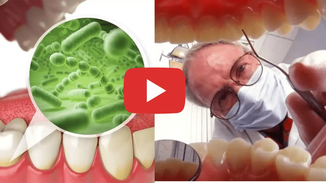 Natural solution to Bad Breath, Gingivitis, Bleeding and Receding gums ...